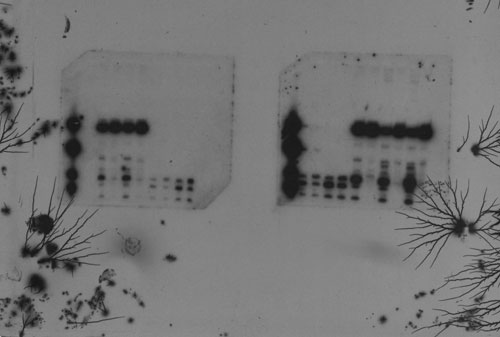 What is Static and How to Reduce It
