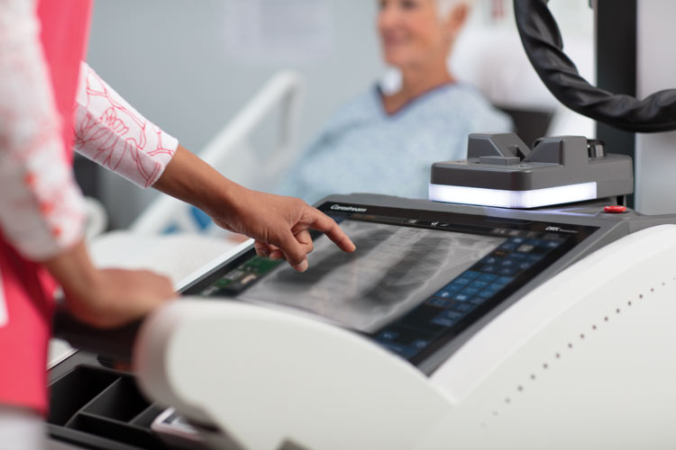 Mobile X-Ray | DRX-Revolution | Carestream