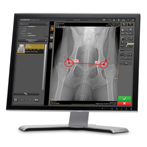 Image Suite | Computed Radiography | Carestream