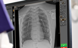 Carestream: Inicio